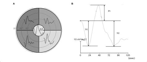 Stimulus Patterns Used To Elicit The Multifocal Electroretinograms