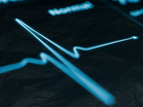 Left Bundle Branch Block Symptoms Causes And Treatment