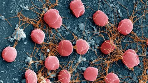 Pyrococcus Furiosus Alchetron The Free Social Encyclopedia