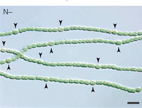Figure 24 From Fixed Nitrogen Dynamics And Heterocyst Patterning In