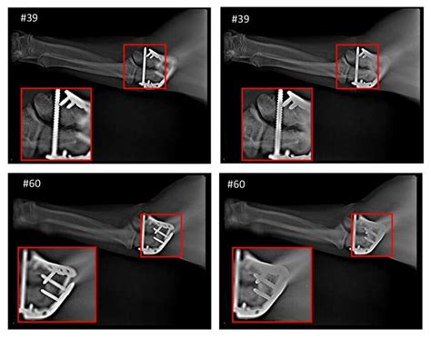 Left Column Reconstruction Slices Of The Bone And Soft Tissue Without Download Scientific