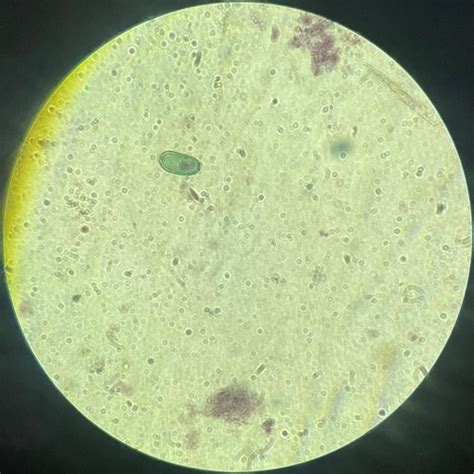 Lab Exam 2 Flashcards Quizlet