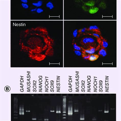 Pdf Sciatic Nerve Regeneration By Transplantation Of In Vitro