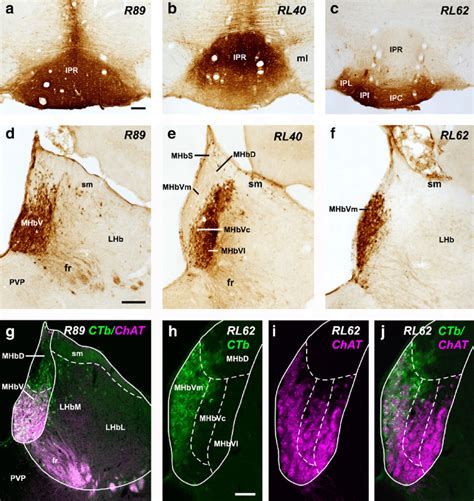 Fig Ure 7 Photomicrographs Of Immunoperoxidase Stained Sections