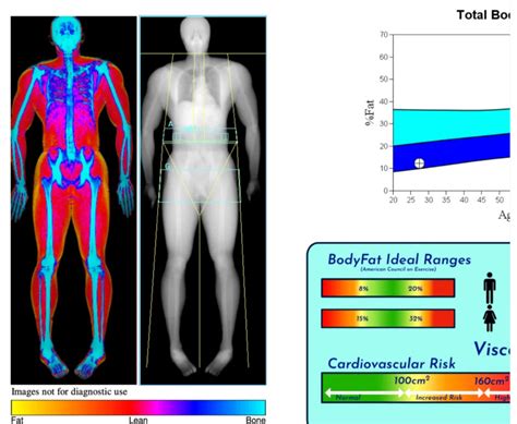 Dexa Scan Jwr Wellness Clinics