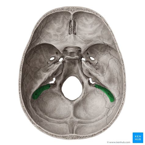 Groove For Sigmoid Sinus Sulcus Sinus Sigmoidei Image Yousun Koh Osso Esfenoide Anatomia
