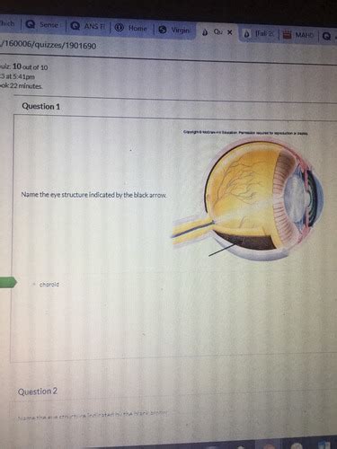 Ap2 Lab Quiz 2 Flashcards Quizlet