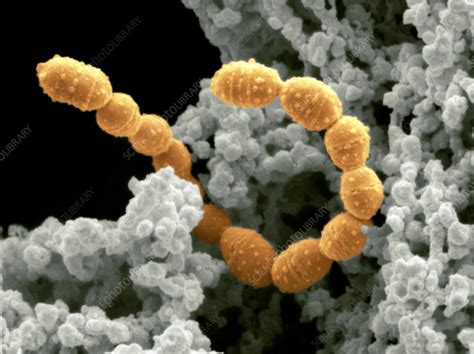 Lactococcus Bacteria In Yogurt Sem Stock Image C028 3410 Science Photo Library