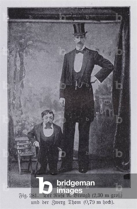 Dwarfism And Gigantism