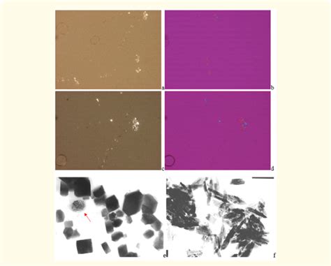 A 4f 2170 2019 Right Shoulder Puncture Unstained Synovial Fluid Download Scientific A 4f 2170 2019 Right Shoulder Puncture Unstained Synovial Fluid Download Scientific