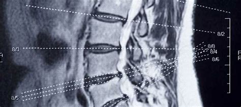 Online Mri Certification Program And Training