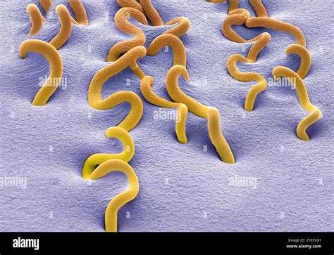 Drug Resistant Aspergillus Coloured Scanning Electron Micrograph Sem Magnification X1200