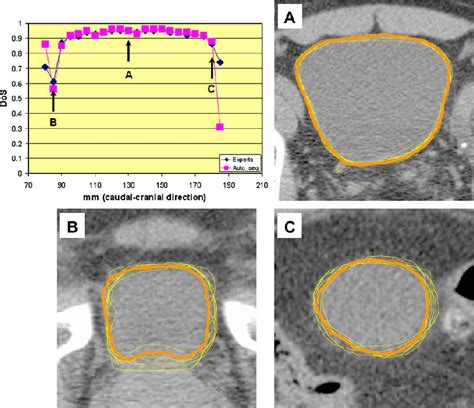 2 Three Ct Images With Different Clinical Contours From [2] At Download Scientific Diagram