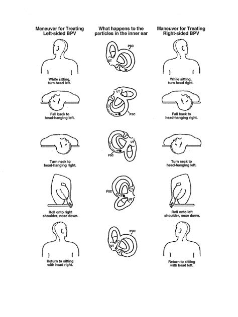Particle Repositioning Maneuver1 Pdf