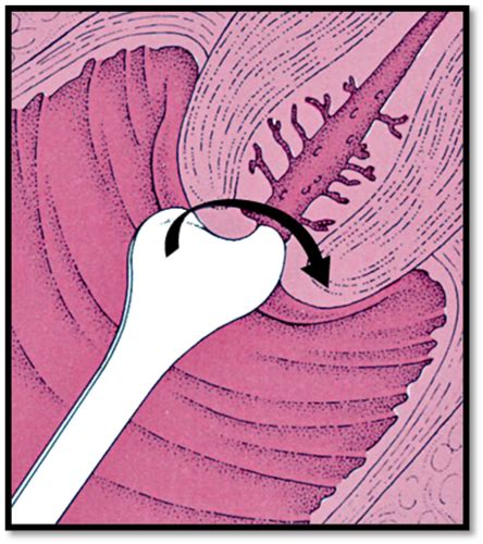 Cervical Disorders Flashcards Quizlet