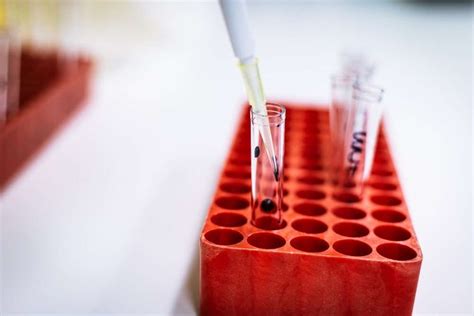 Digital Article Immunophenotyping For Targeted Drug Discovery Drug Discovery World Ddw