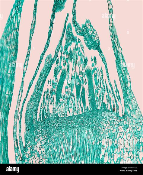 Archegonial Head Moss Mnium Showing Eggs Other Structures Longitudinal Section Magnification 30x