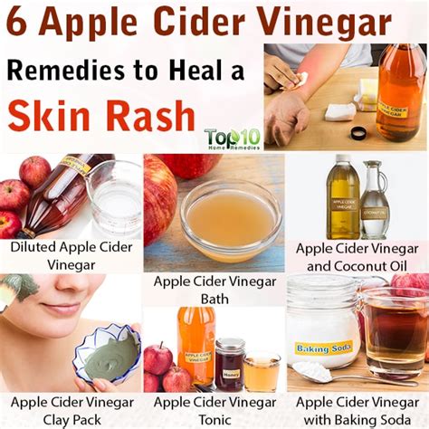 How To Cure A Skin Rash Fast At Emma Gibney Blog