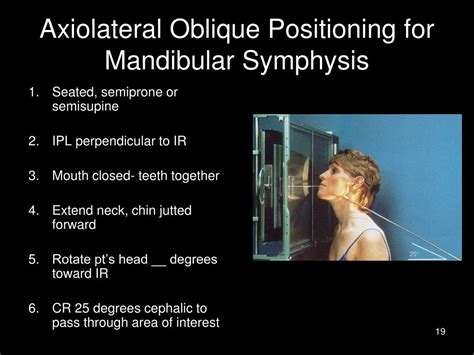 Ppt Week 7 Mandible Week 8 Tmj Powerpoint Presentation Free