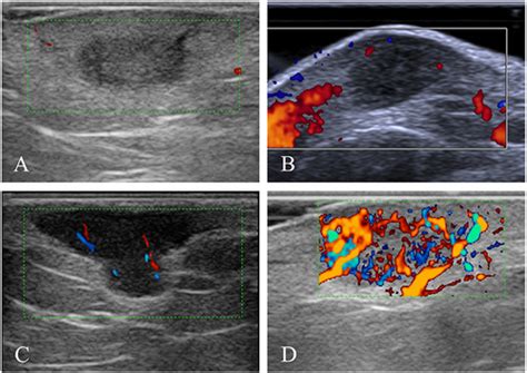 Full Article Evaluation Of Very High Frequency Ultrasound Imaging