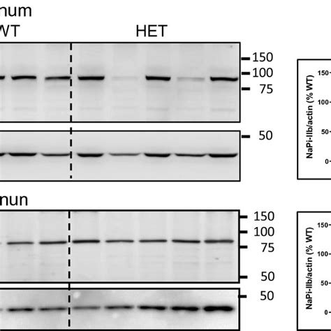 Expression Of Napi Iib In Total Membranes Isolated From Mucosa Of A Download Scientific