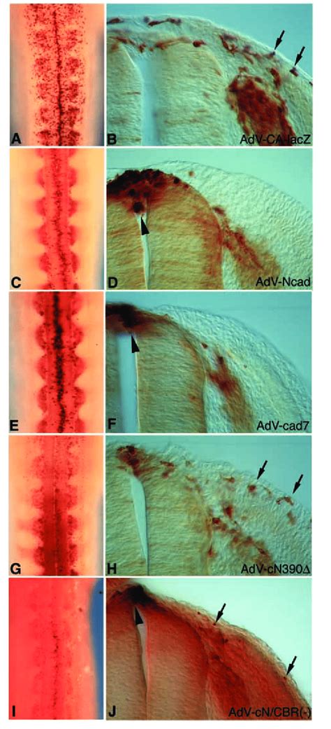 Behavior Of Neural Crest Cells Ectopically Expressing Various Cadherin Download Scientific