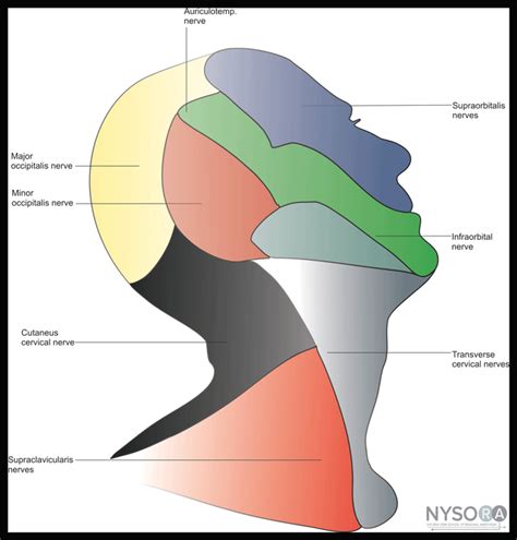 Cervical Plexus Block Nysora The New York School Of Regional Anesthesia