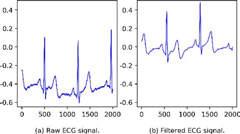 Figure 1 From A Practical Cross Domain Ecg Biometric Identification Method Semantic Scholar