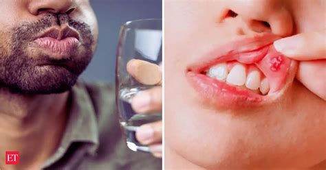 Cancer Mouth Wash Do You Use Listerine Cool Mint Mouthwash It May