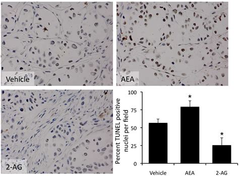 Figure 1 From Opposing Actions Of Endocannabinoids On Cholangiocarcinoma Growth Is Via The