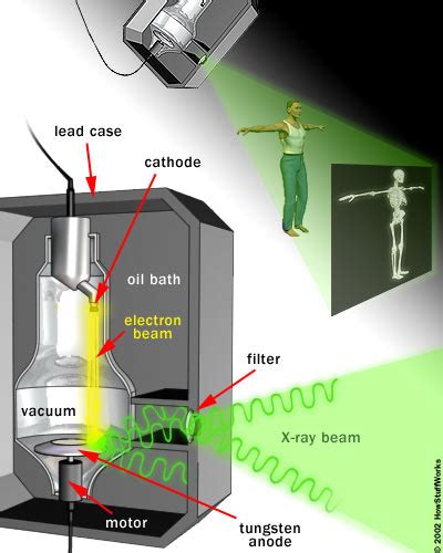 Xrays Definition Block Diagram And Working Of Xray