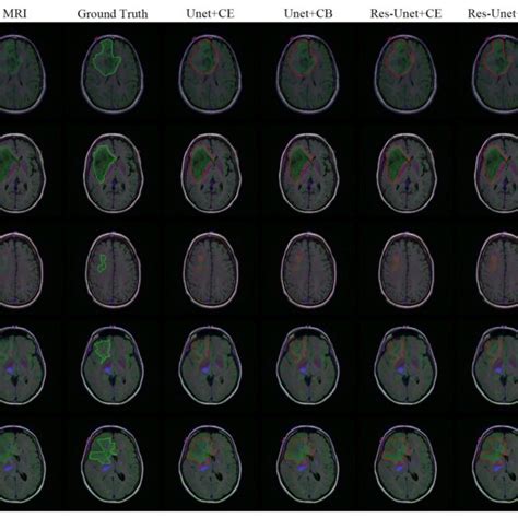 Predictions Of Models And Ground Truth On Samples Download Scientific Diagram