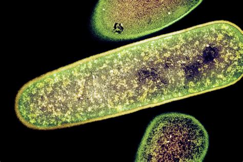 ภาพรวมของ C Diff Medthai