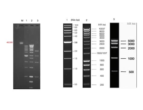 Solved Gel Electrophoresis Analysis 4 Different Markers Were