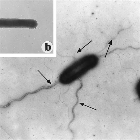 Principal Characteristics Distinguishing Phases And Motility Of