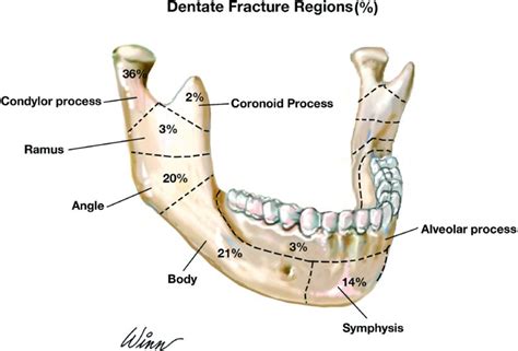 The Comprehensive Aocmf Classification System Mandible 47 Off