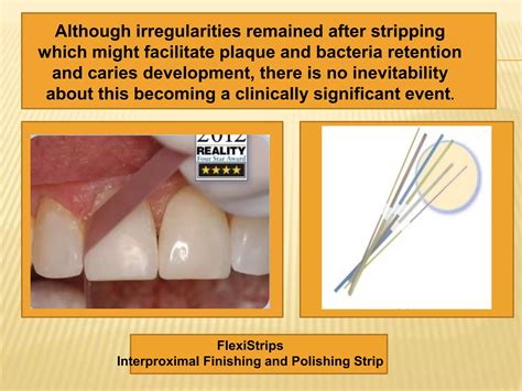 Interproximal Reduction Of Enamel As Part Of Orthodontics PPTX