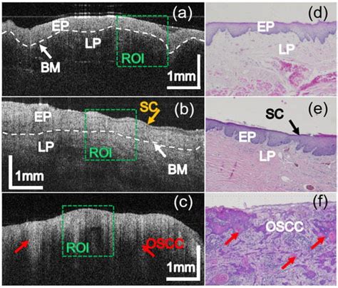 Deep Learning Based Automated Identification And Visualization Of Oral