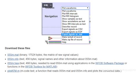 Mimic数据库中数据的下载以及matlab读取mimic数据库怎么在matlab中使用 Csdn博客 Mimic数据库中数据的下载以及matlab读取mimic数据库怎么在matlab中使用 Csdn博客