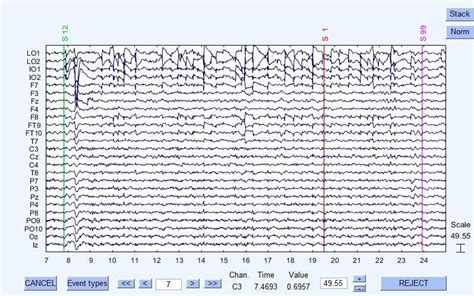 The EEG Data With Its Triggers And Prescience Time Stamps Provided By Download Scientific