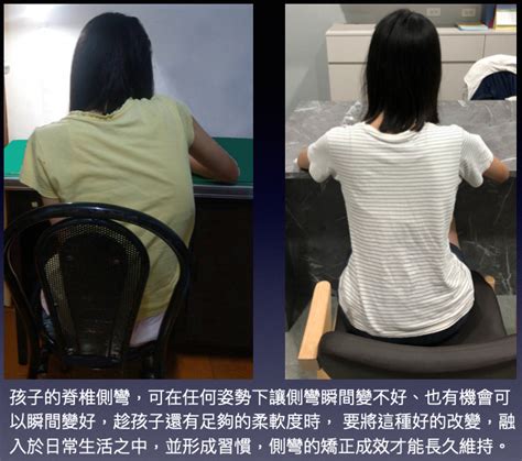 閻曉華側彎研究中心 脊椎側彎矯正治療的重點，是要學習用另一種方式來使用身體，並隨時隨地的應用於日常生活當中，如果側 Facebook
