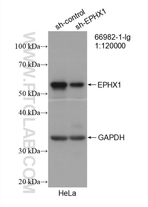 EPHX1 antibody (66982-1-Ig) | Proteintech