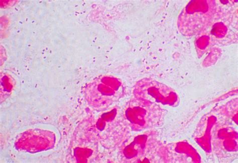 Escherichia Coli〔大腸菌〕 グラム染色 Gram Stain