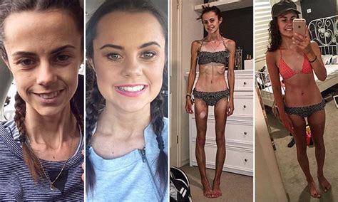 Blogger Documents Her Anorexia Recovery With Before And After Photos On