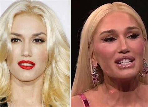 Gwen Stefani Plastic Surgery Interview Reddit Users Are Curious About