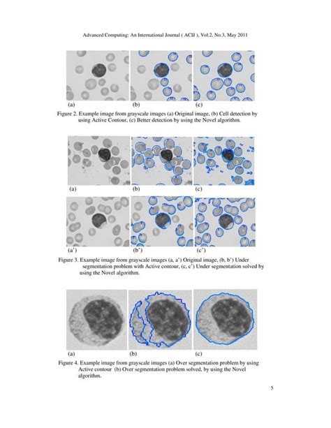 A Novel Image Segmentation Enhancement Technique Based On Active Contour And Topological