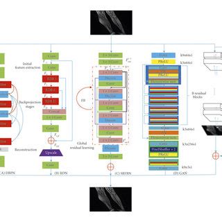 A Unified Framework Of Deep Learning Based MRI Super Resolution