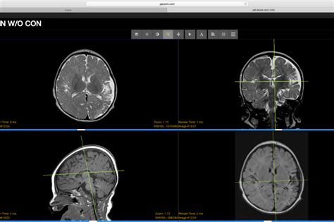 Best Dicom Viewer Mac Statepole