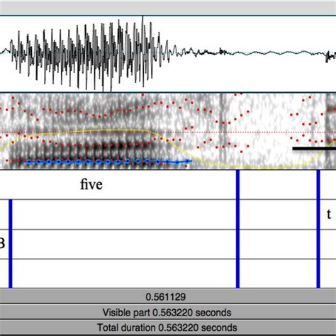 Spectrogram Of T̪ By Ma89 Download Scientific Diagram