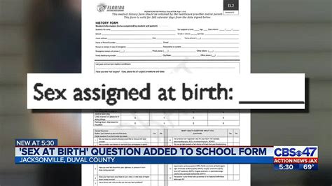 Sex At Birth Question Added To Babe Form Action News Jax